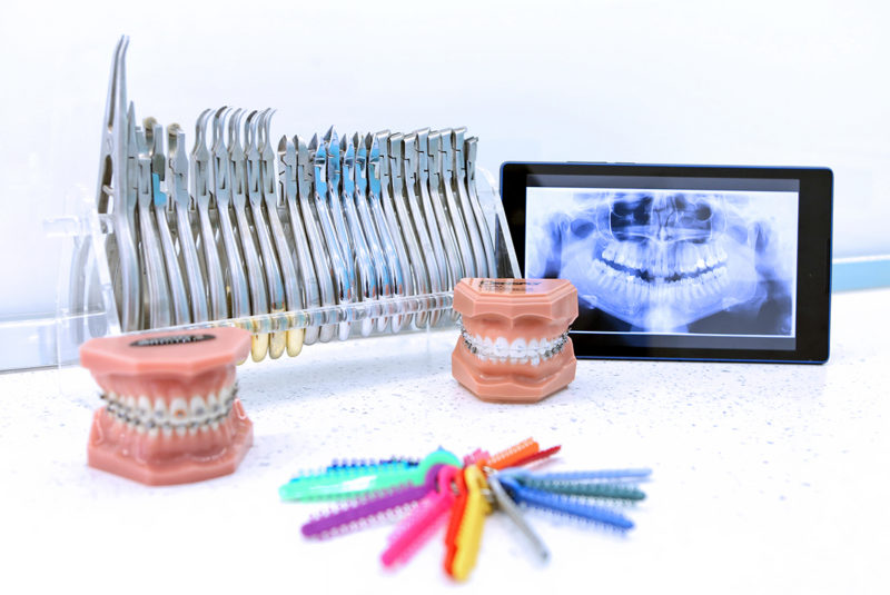 Ortodoncija - Dentalna Poliklinika Kranjčević Bubica