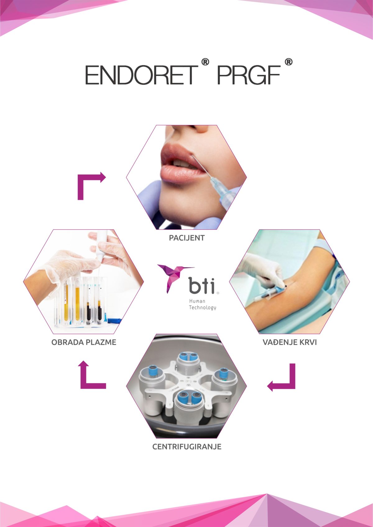 PRGF® Endoret® - Dentalna Poliklinika Kranjčević Bubica