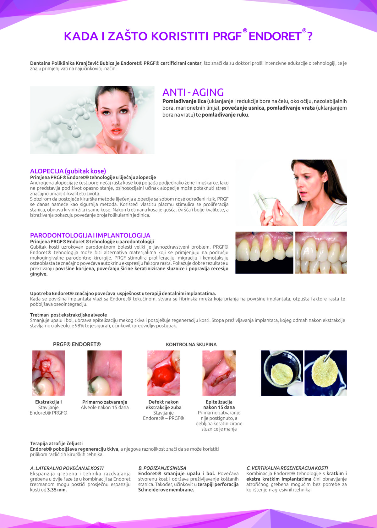 PRGF® Endoret® - Dentalna Poliklinika Kranjčević Bubica