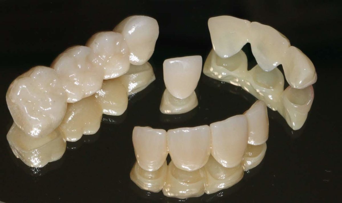 Dentalna protetika – Dentalna Poliklinika Kranjčević Bubica